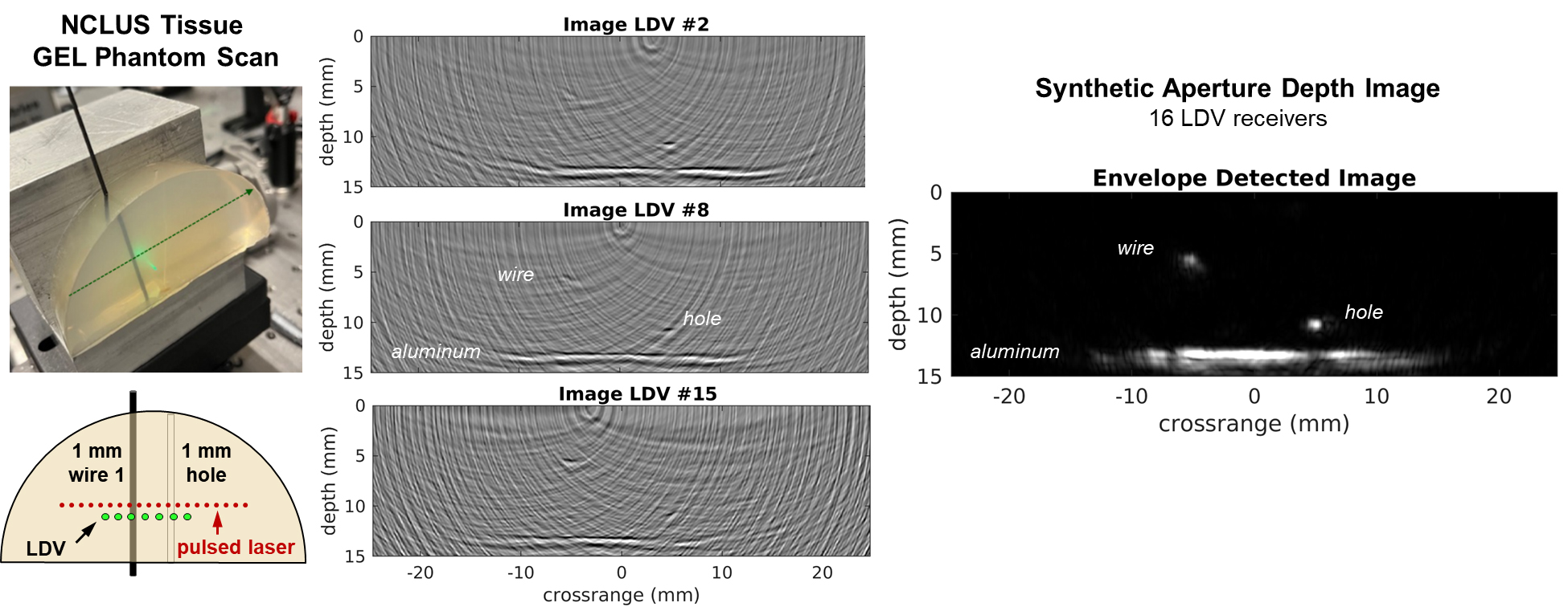 Laser-based system achieves noncontact medical ultrasound imaging | MIT Lincoln Laboratory